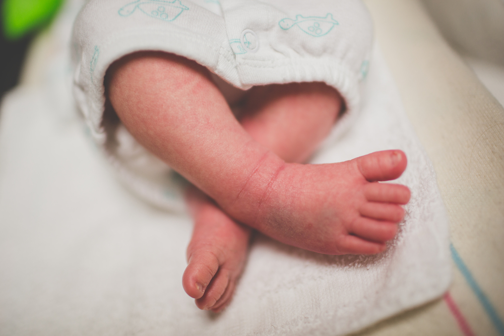 Bruising and Petechiae - Birth Injury Guide