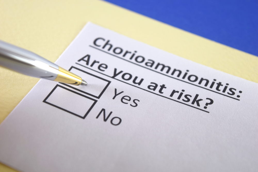 Chorioamnionitis Baby