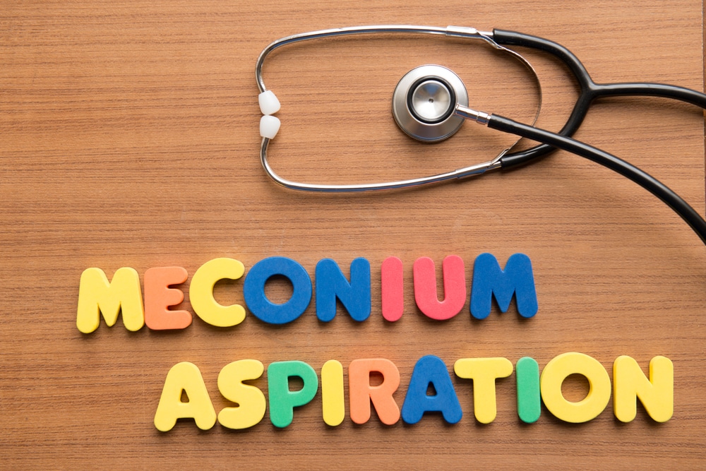 Meconium Aspiration Syndrome (MAS) | Birth Injury Guide