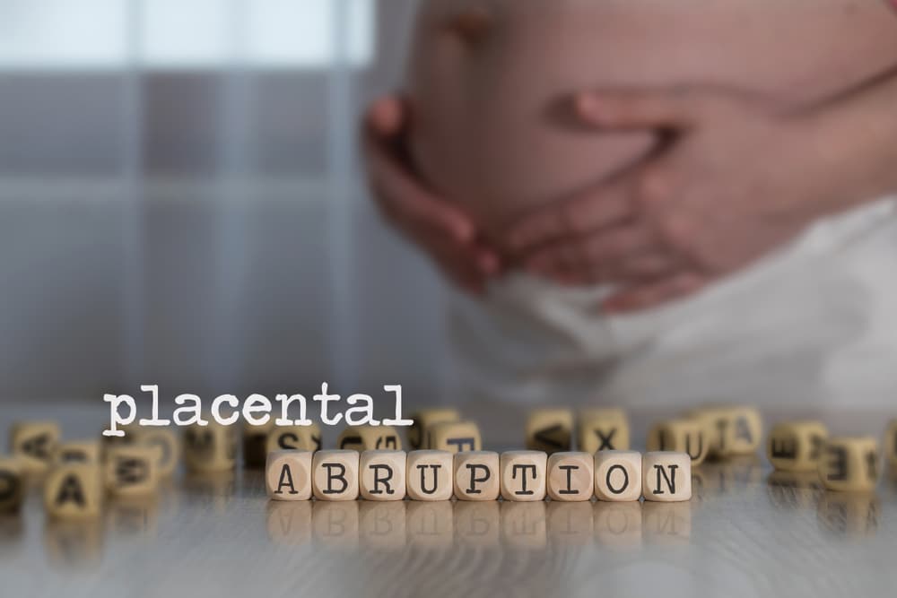 Placental Abruption | Birth Injury Guide