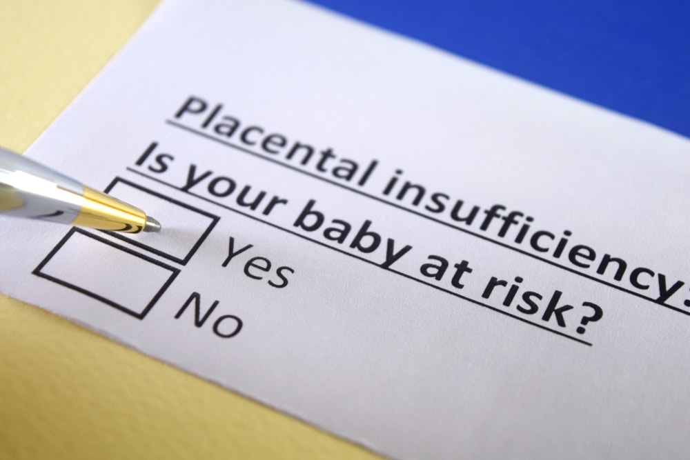 Placental Insufficiency: Pregnancy and Birth | Birth Injury Guide
