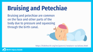 Bruising and Petechiae - Birth Injury Guide