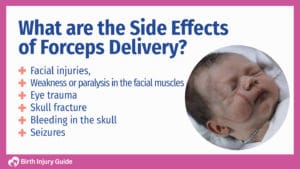 What are the Side Effects of Assisted Delivery? - Birth Injury Guide